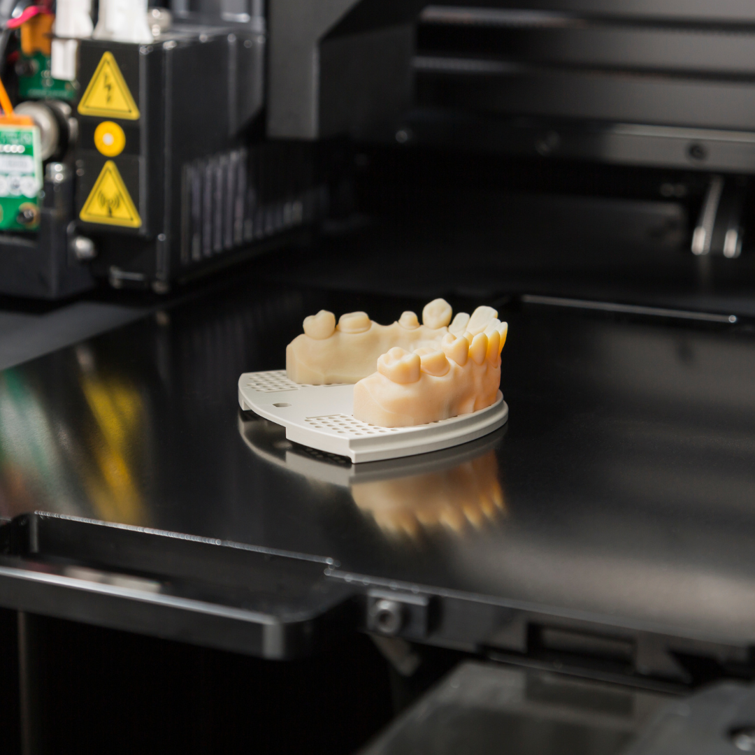 What Is 3D Printing in Dentistry? - Sheema’s Smile Secrets