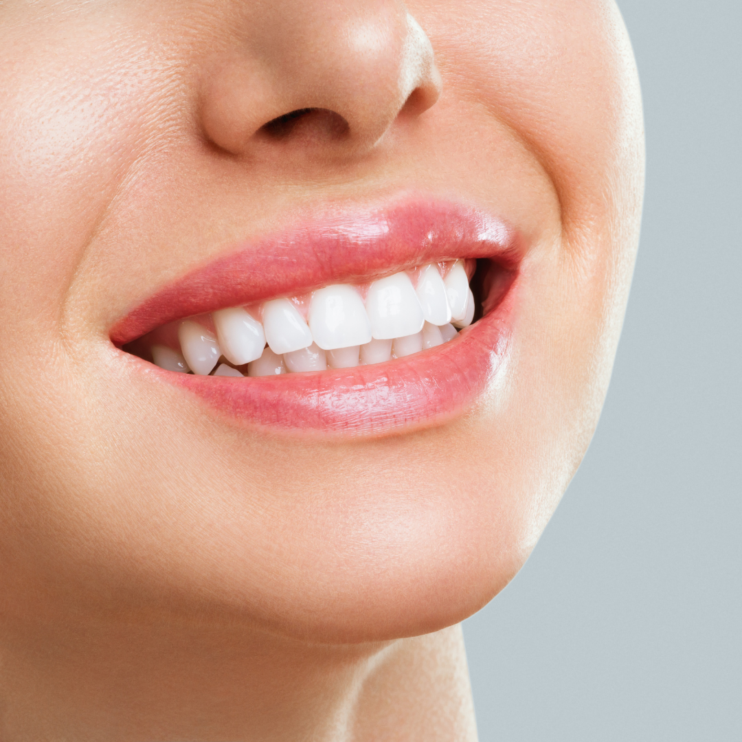 How Teeth Alignment Impacts Overall Health